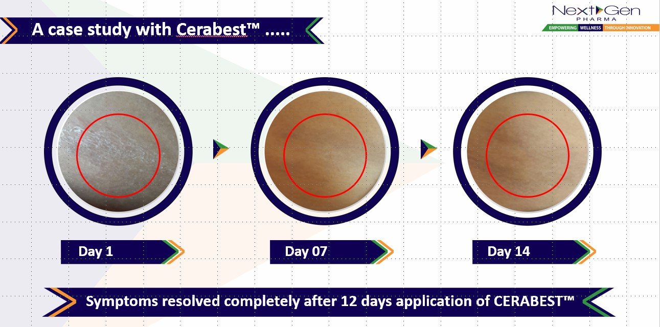 Cerabest® - Nextgenlife